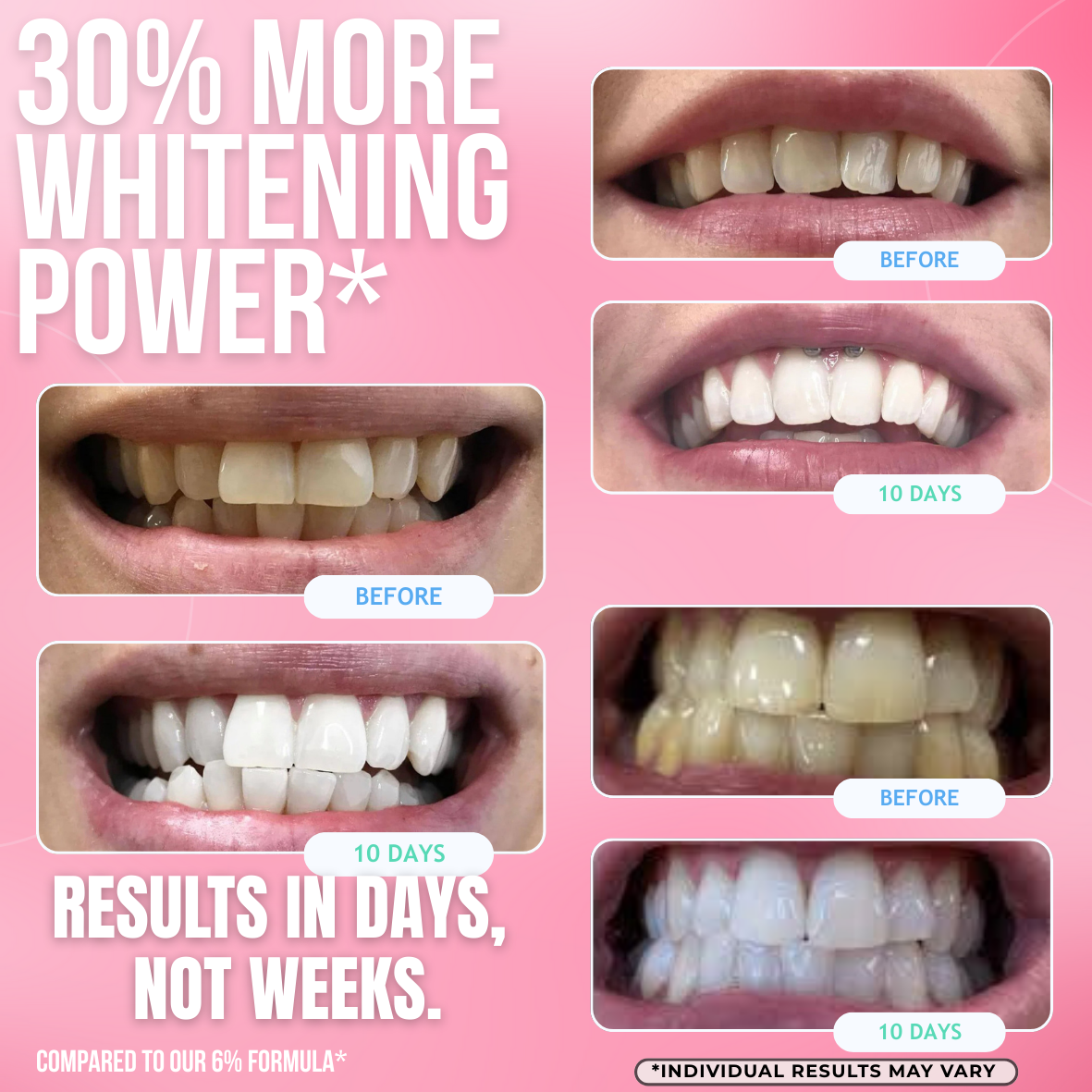 Glow Strips - 10 Express Teeth Whitening Strips & Pen | 8% Professiona ...